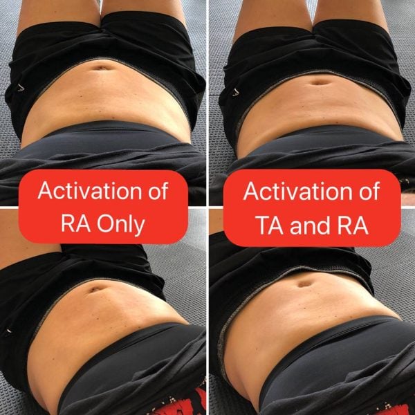 Diastasis Recti (DRA): Approaching Core Exercises to Enhance Healing ...