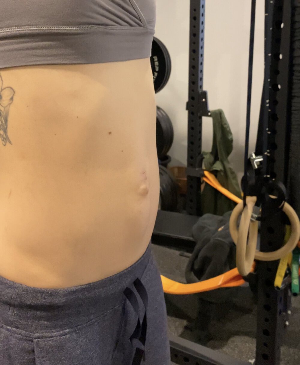 Understanding Coning: What is it and how to fix it! - MamasteFit