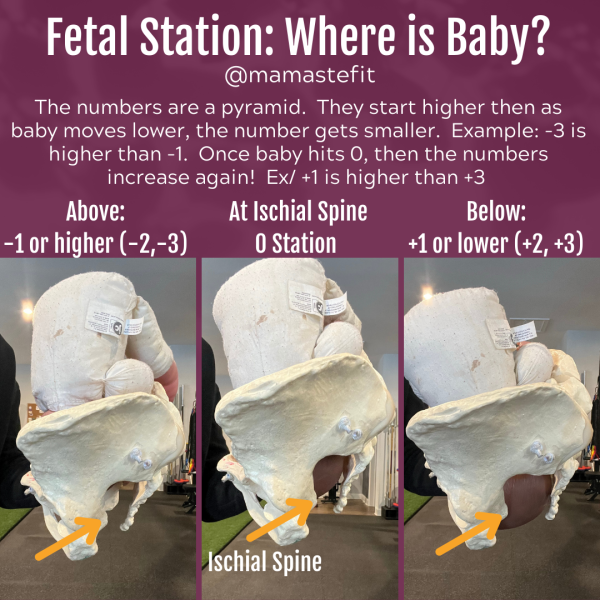 3 Pelvic Levels of Fetal Station: Understand Where Baby is!