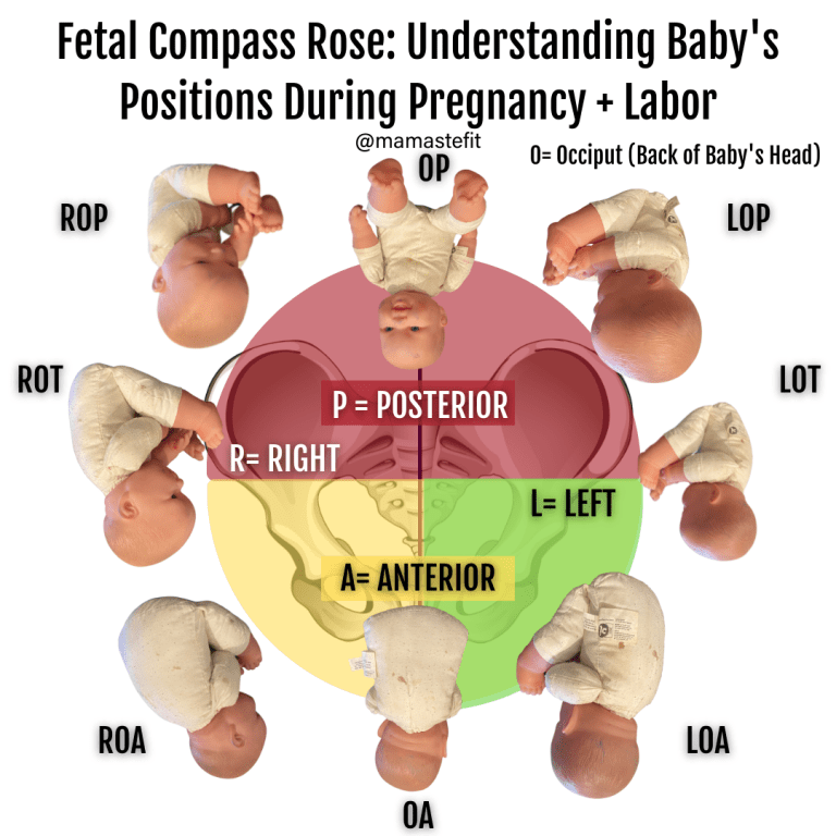 Baby’s Position: 3 Movements to Fix an OP or Posterior Baby’s Position ...