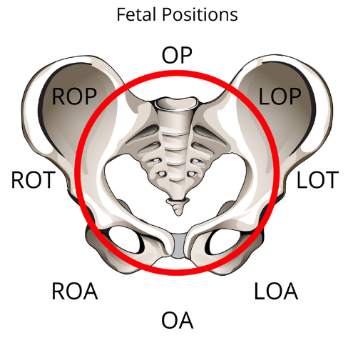 Help! My Baby is OP! Exercises to Help Rotate an OP Baby - MamasteFit