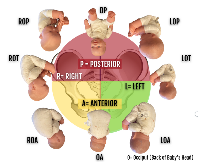 Is Baby’s Position Slowing Your Labor? How to Fix It Fast - MamasteFit