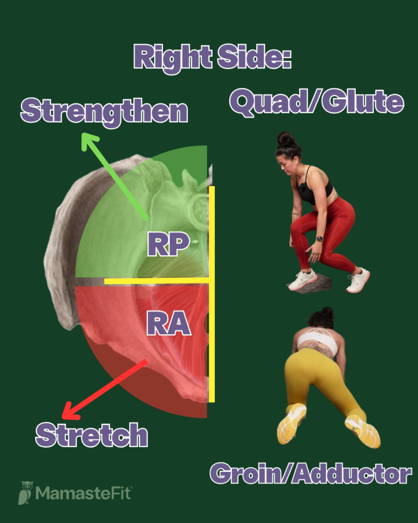 The Pelvic Floor Balance Approach: Why Strength and Stretching Aren’t ...